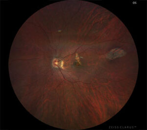 Services - Vista Eye Center